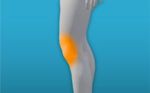 Current Vacancies | Swan Medical Group